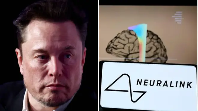 First human gets brain implant 'to control phone or computer just by ... First human gets brain implant 'to control phone or computer just by ...